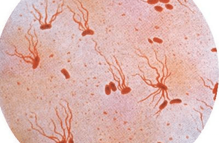 A typhoid outbreak is hitting Auckland. Where did it come from and what ...