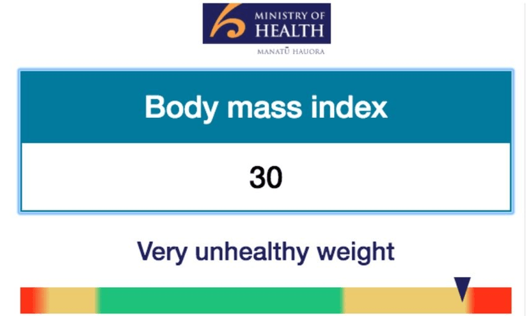 It’s time to get rid of the BMI test once and for all | The Spinoff