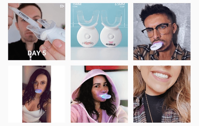 What’s the deal with influencers and their teeth whitening gizmos ...