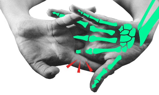 Irritating, yes, dangerous, no: The truth about cracking your knuckles ...